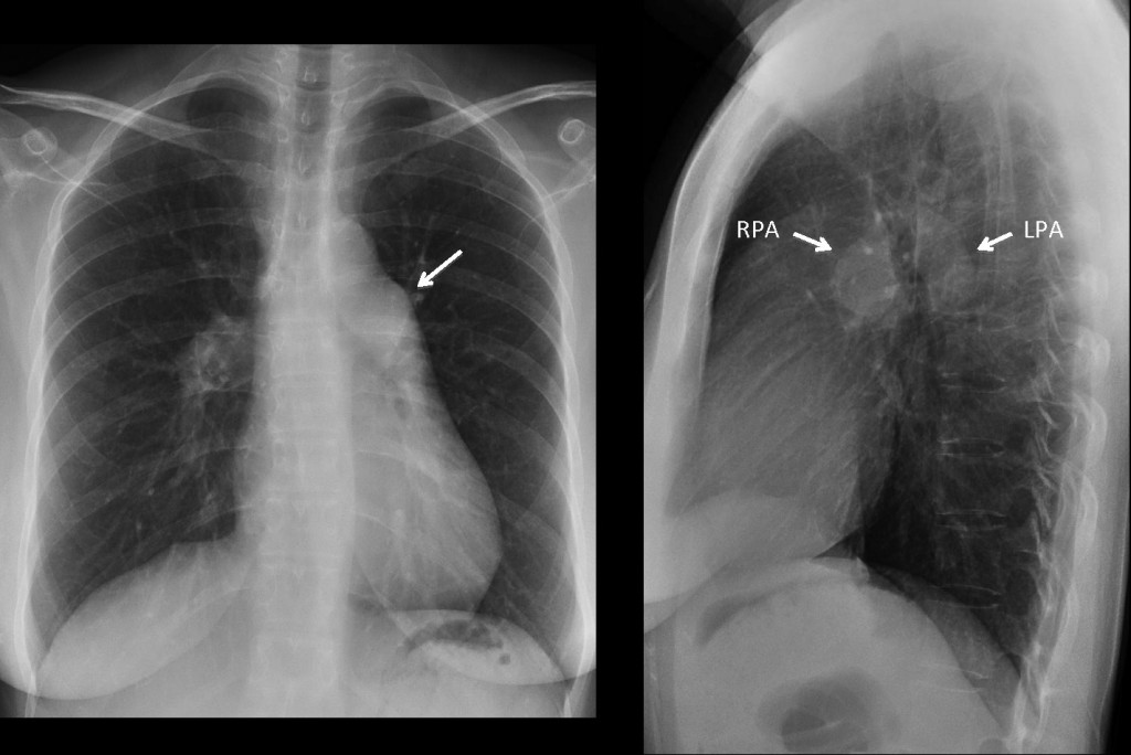 Caceres’ Corner: Case No.14 (Update: Solution) | Blog